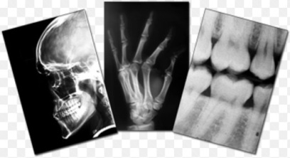 Florida X-Ray Film Recycling and X-Ray Film Disposal